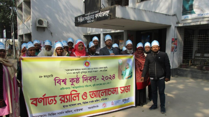 Thrust for ensuring dignity of the leprosy people cured from disease in ...